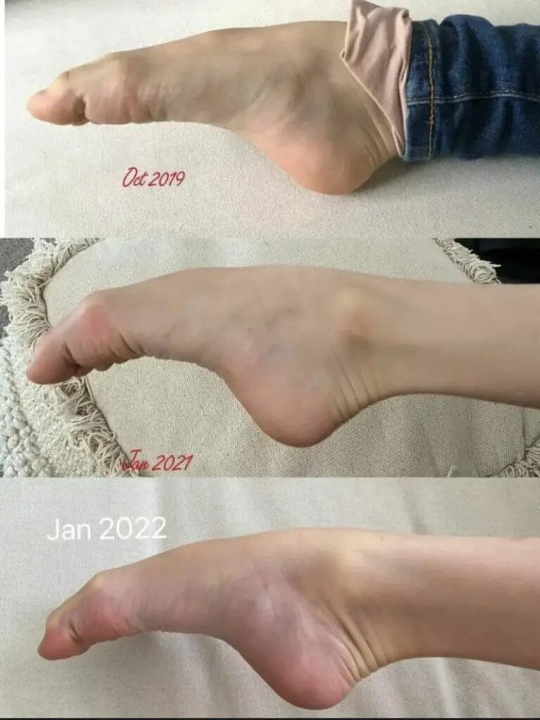 Does Ballet Ruin Your Feet? (Explained for Beginners) – Dance Gaily Does Ballet Ruin Your Feet? (Explained for Beginners) – Dance Gaily